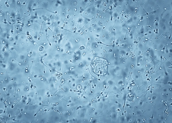 Traiter l'Asthénospermie Naturellement. Remède asthénospermie